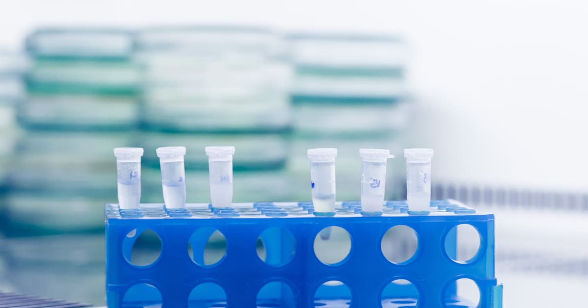 Un nouveau test ADN identifie les auteurs d’agressions même en cas de ...