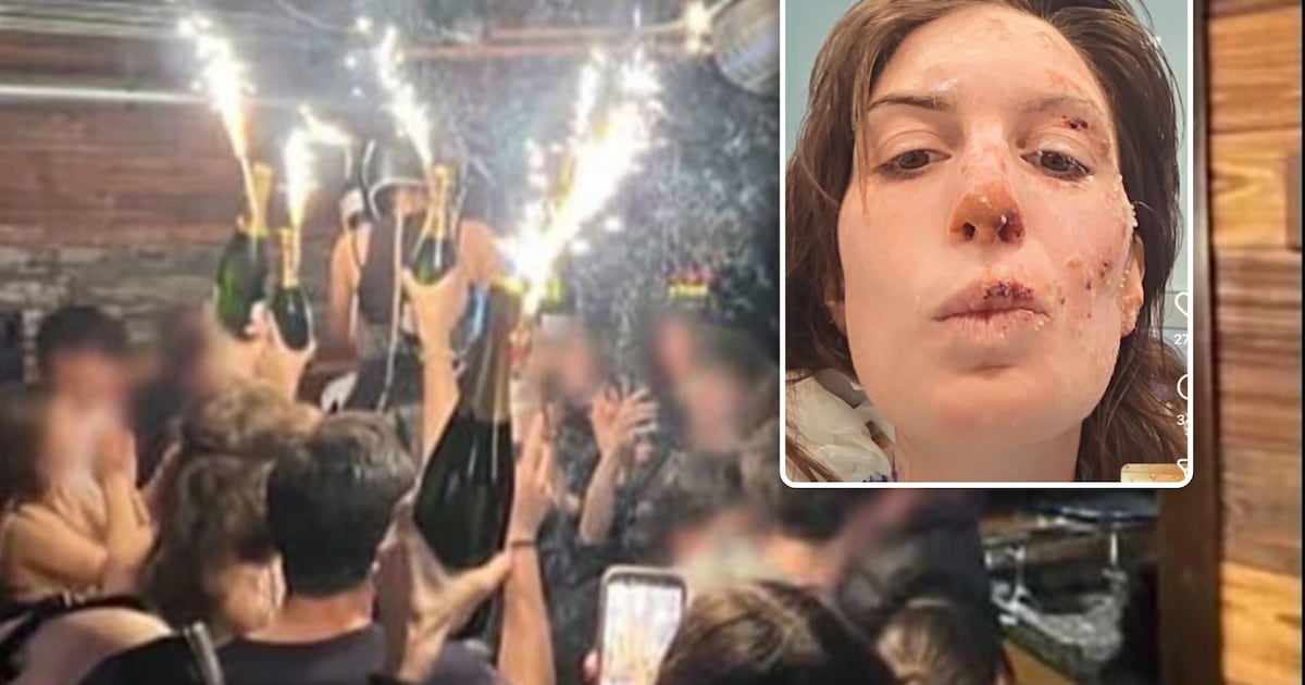 Une victime de Crans-Montana partage des photos de son visage brûlé ...