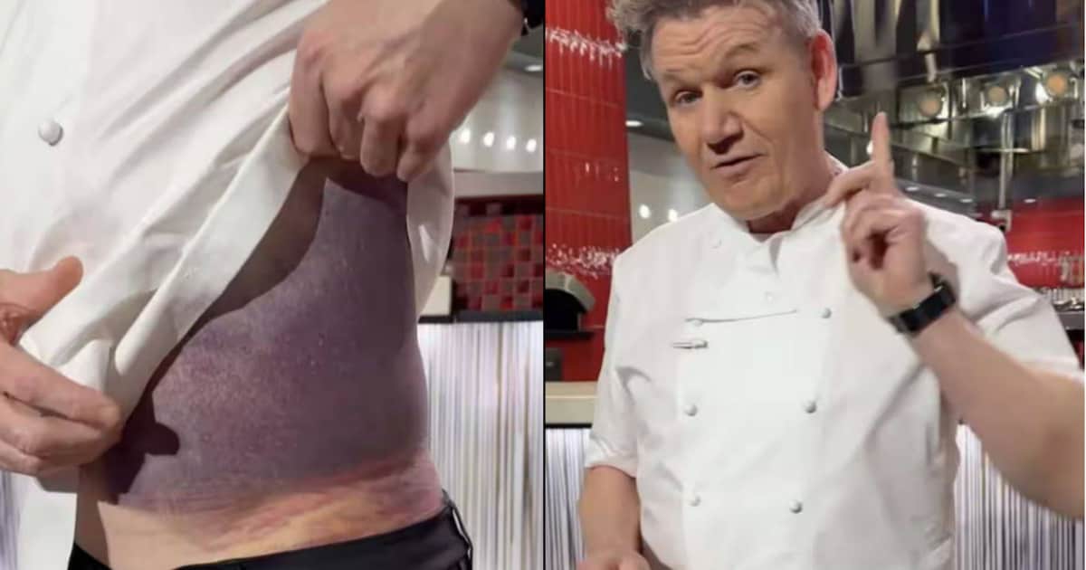 Le chef Gordon Ramsay dévoile son impressionnante blessure après un ...