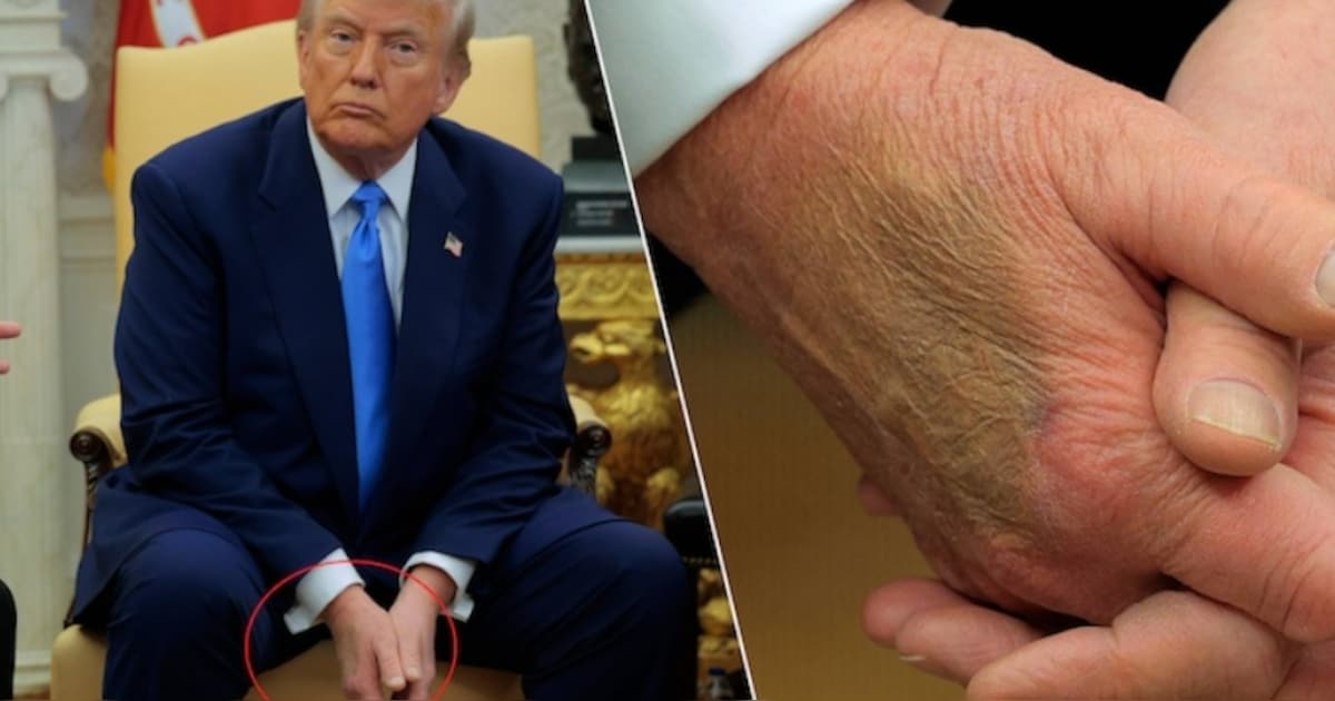Un mystérieux bleu sur la main de Trump: voici l’explication de la ...