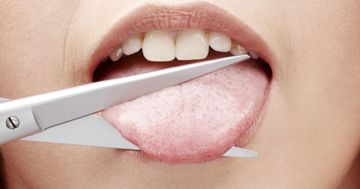 Il se coupe la langue pour que sa femme revienne | 7sur7.be