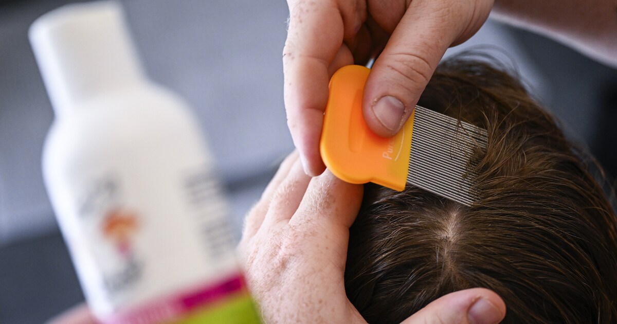 Les poux n’attendent plus la rentrée scolaire pour infester les cheveux ...