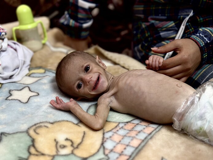 “Elle n’a jamais connu la paix”: l’histoire de Siwar, un bébé devenu symbole de la famine à Gaza ...