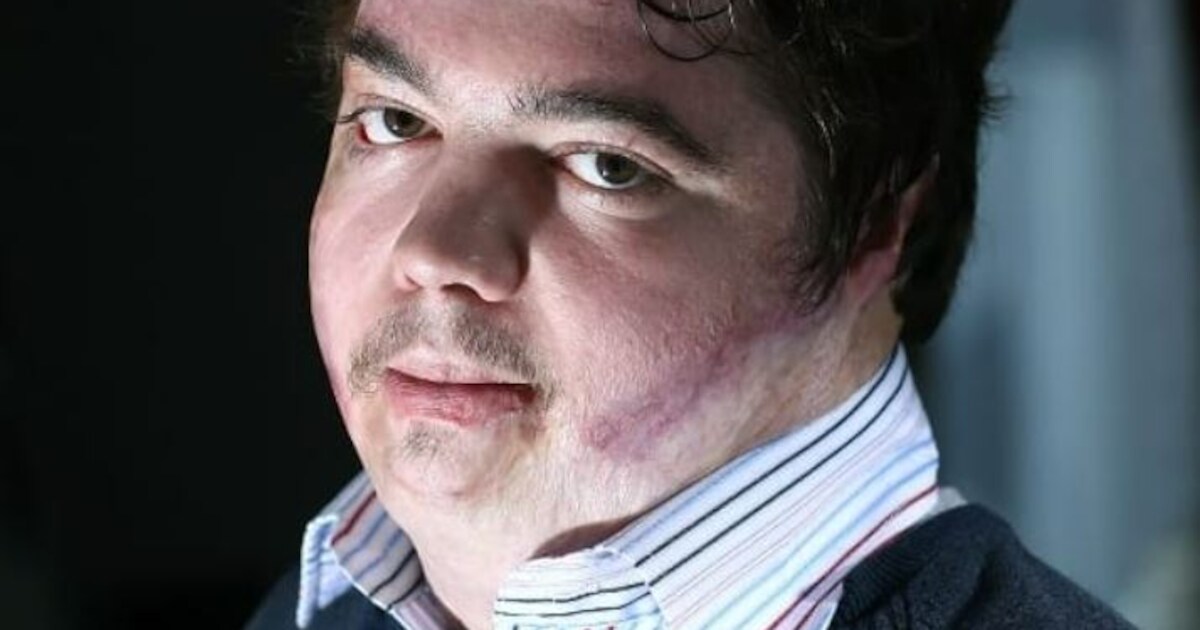 Son histoire avait ému la France: Jonathan Destin, figure de la lutte ...