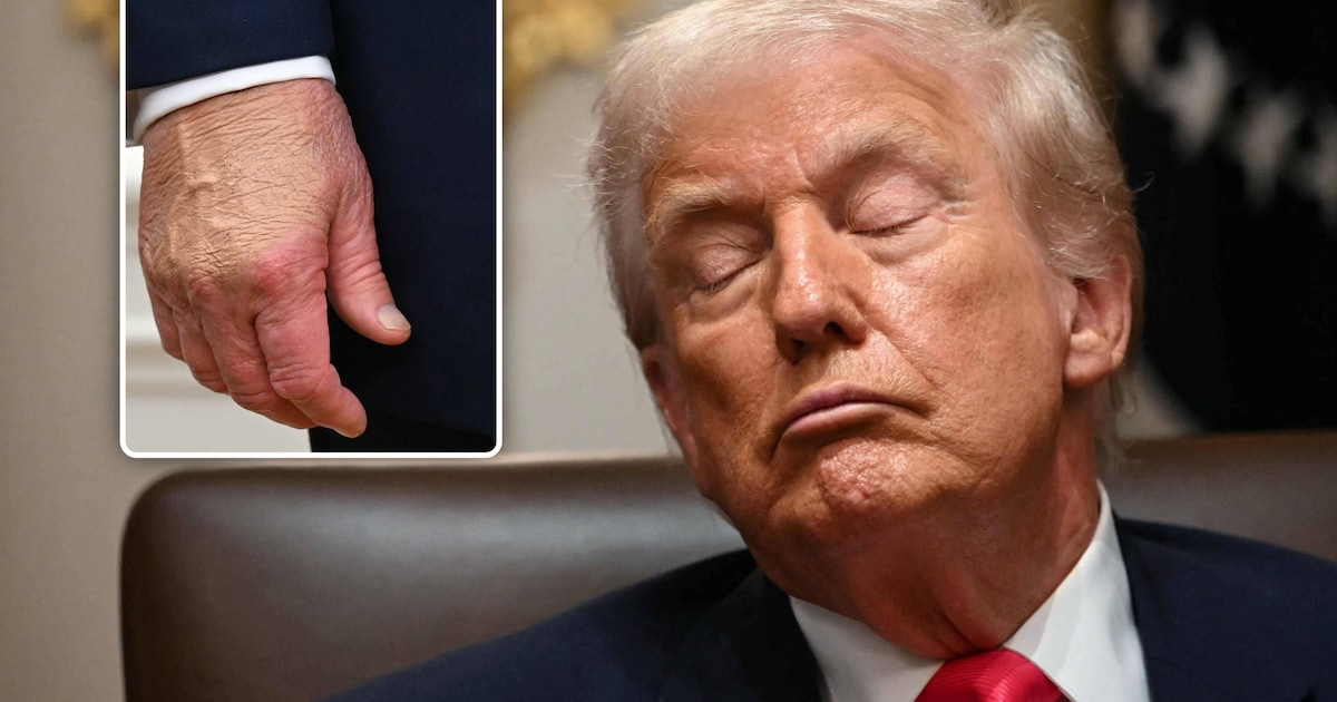 Trump affirme qu’il prend depuis 25 ans plus d’aspirine que ce que les ...